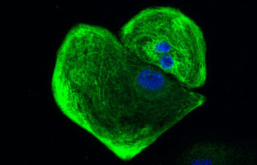 Genetic heart disease | Centenary Institute