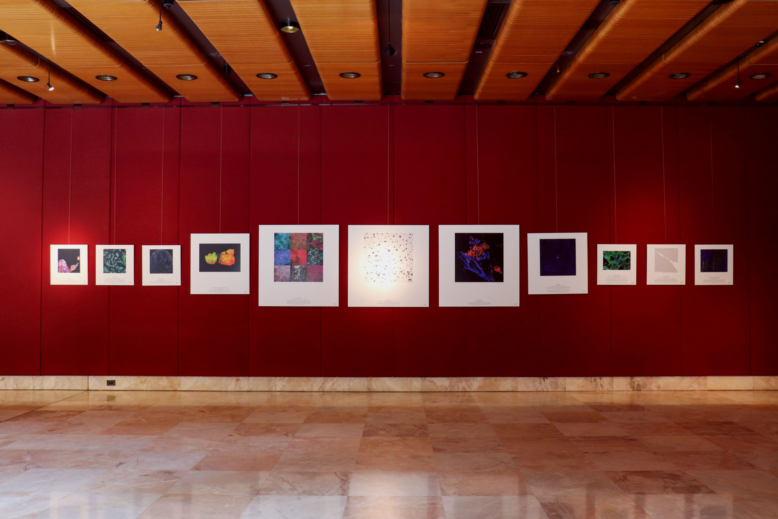 ‘When Art Meets Science’ exhibition now open | Centenary Institute